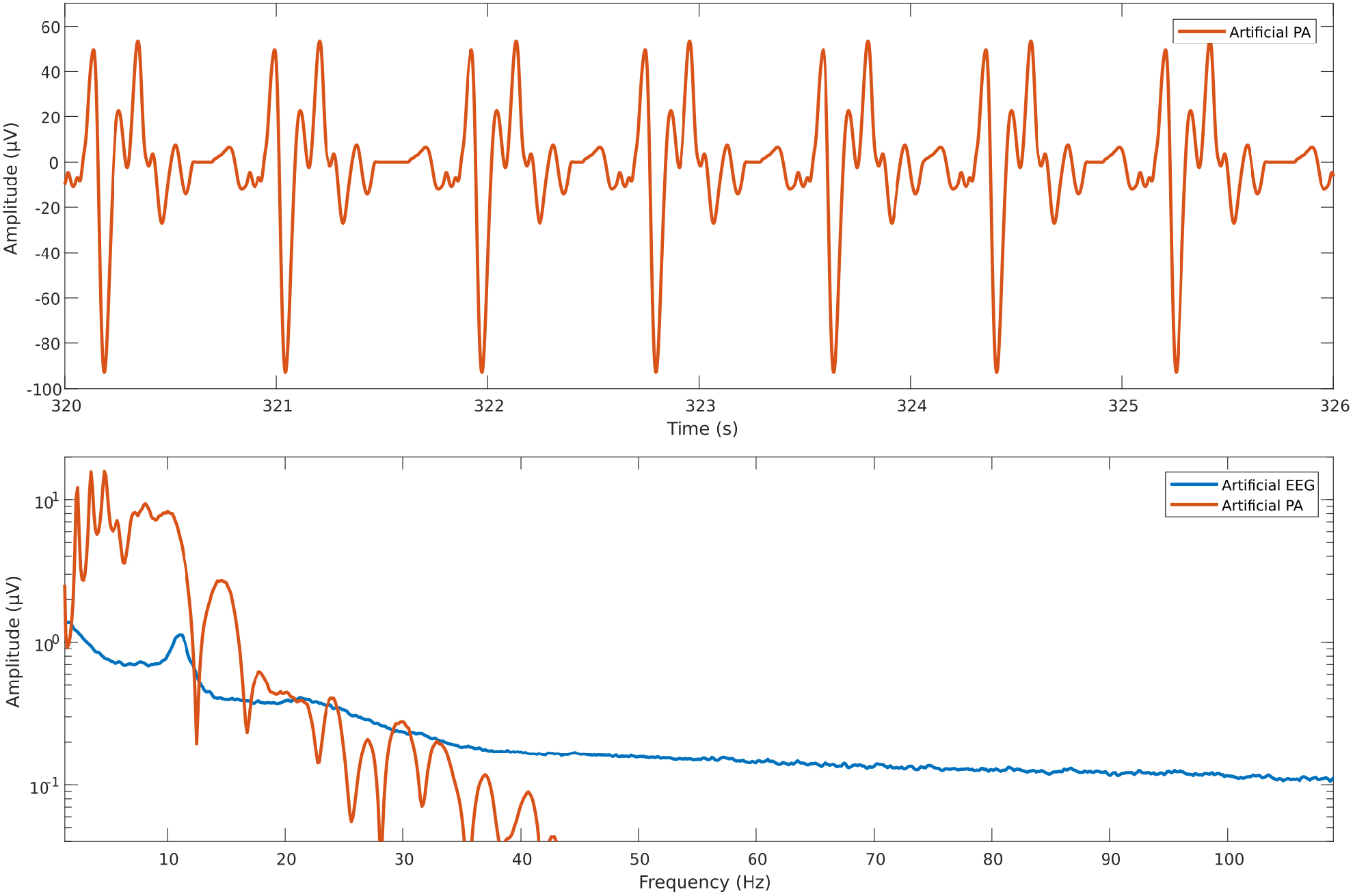 Artifacts in EEG of simultaneous EEG-fMRI: pulse artifact remainders in ...