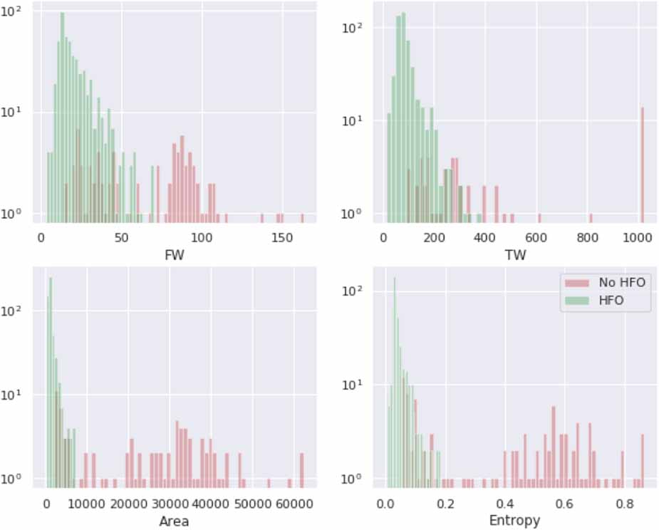 SGM: a novel time-frequency algorithm based on unsupervised learning improves high-frequency ...