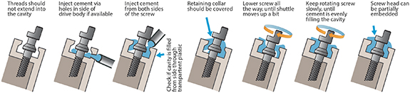 An easy-to-assemble, robust, and lightweight drive implant for chronic ...