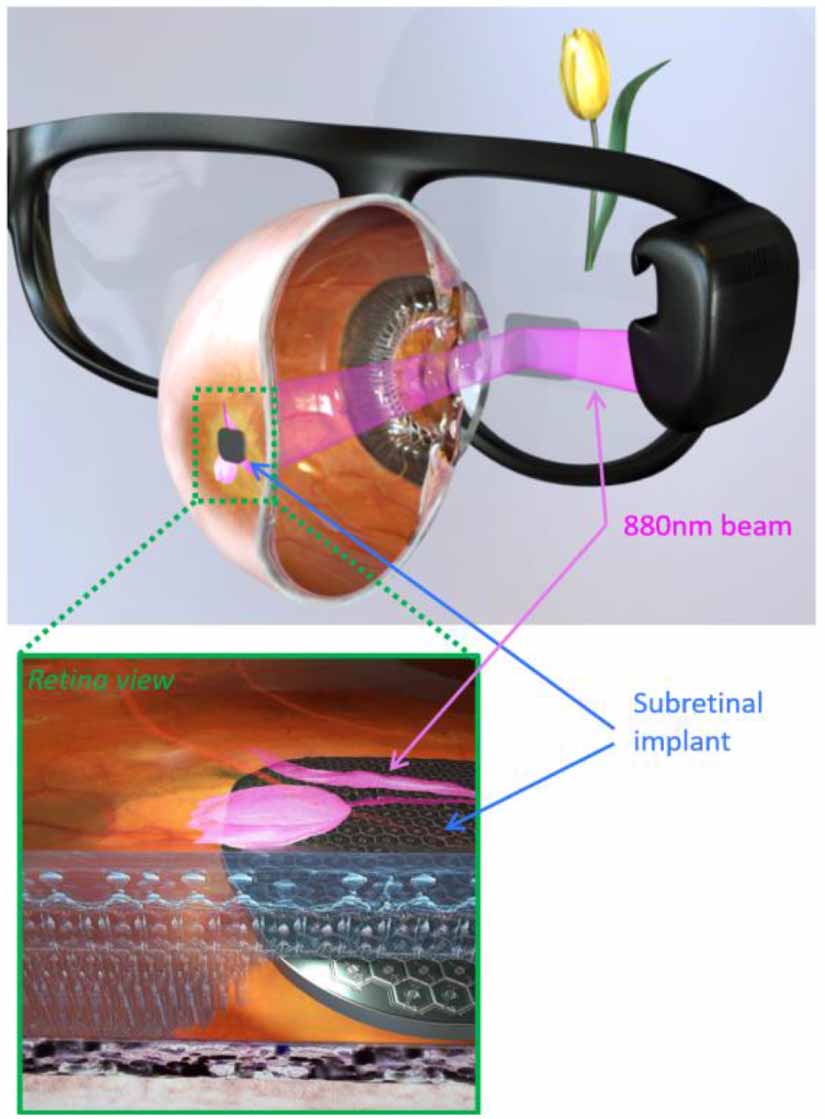 In vitro reliability testing and in vivo lifespan estimation of ...