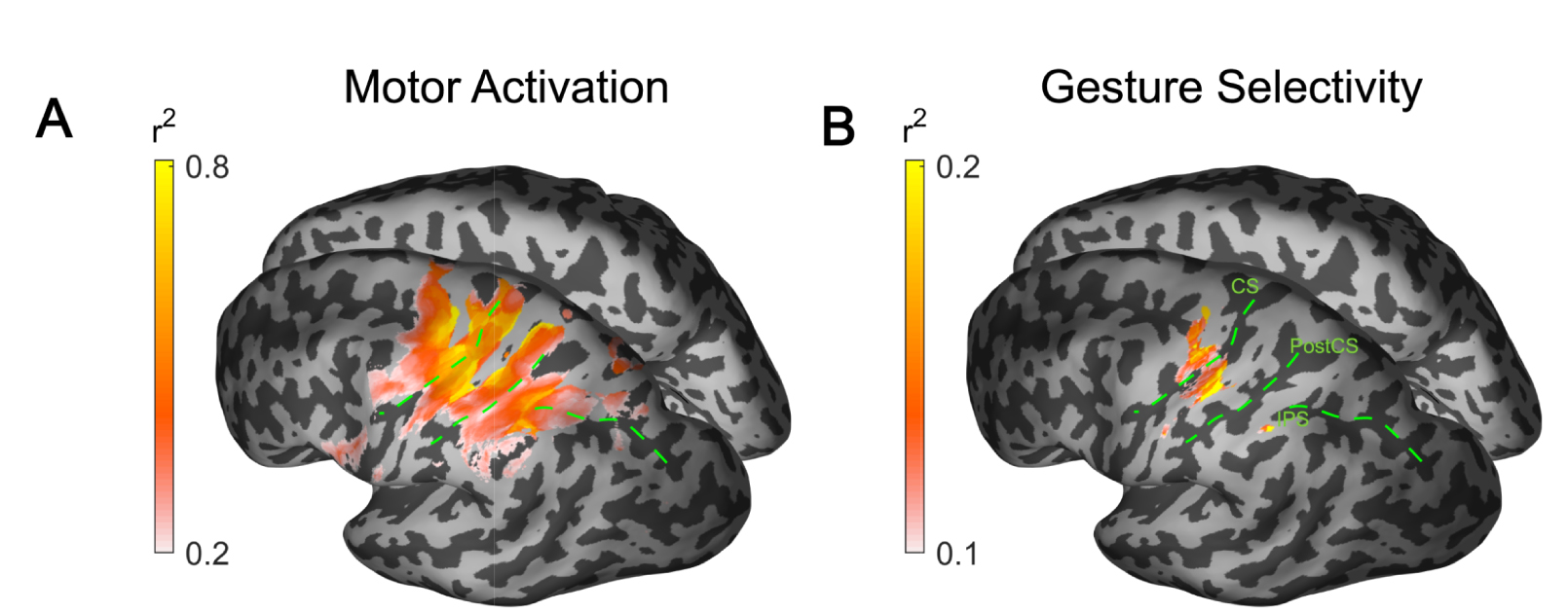 Enhancing gesture decoding performance using signals from posterior parietal cortex: a stereo ...