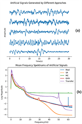 EEG data augmentation: towards class imbalance problem in sleep staging ...