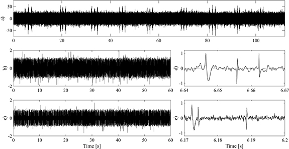 Systematic analysis of wavelet denoising methods for neural signal processing - IOPscience