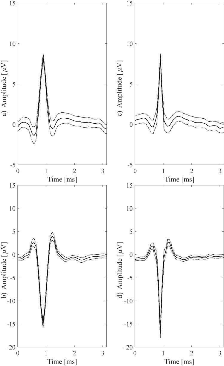 Systematic analysis of wavelet denoising methods for neural signal processing - IOPscience