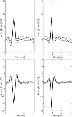 Systematic analysis of wavelet denoising methods for neural signal ...