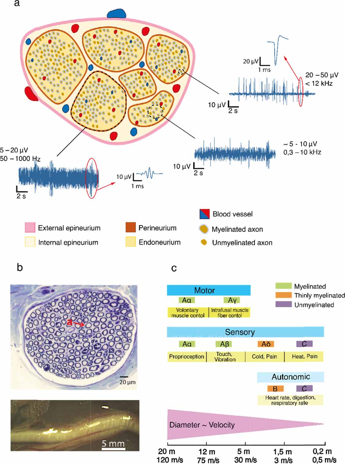 Compliant peripheral nerve interfaces - IOPscience