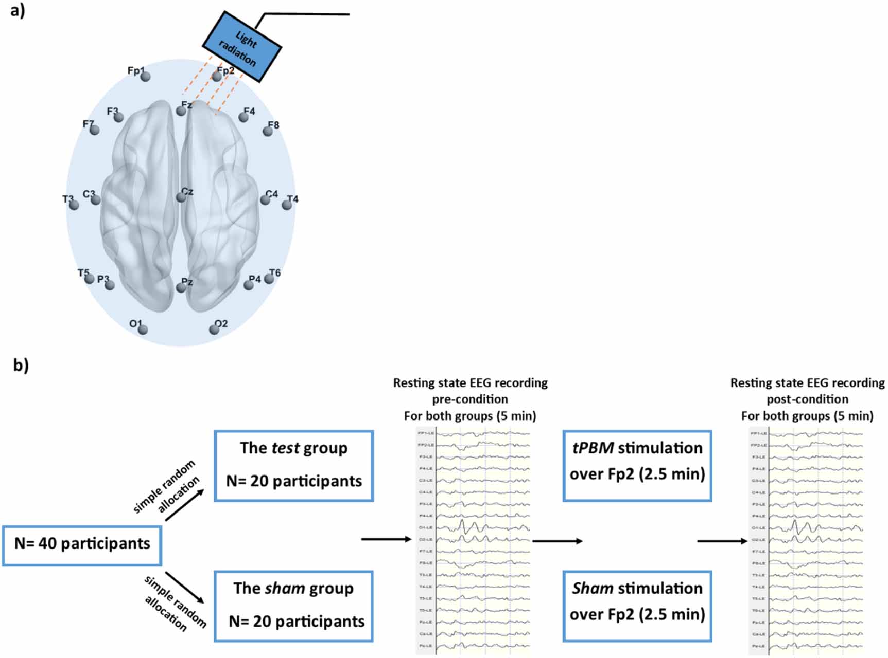 Transcranial photobiomodulation changes topology, synchronizability ...