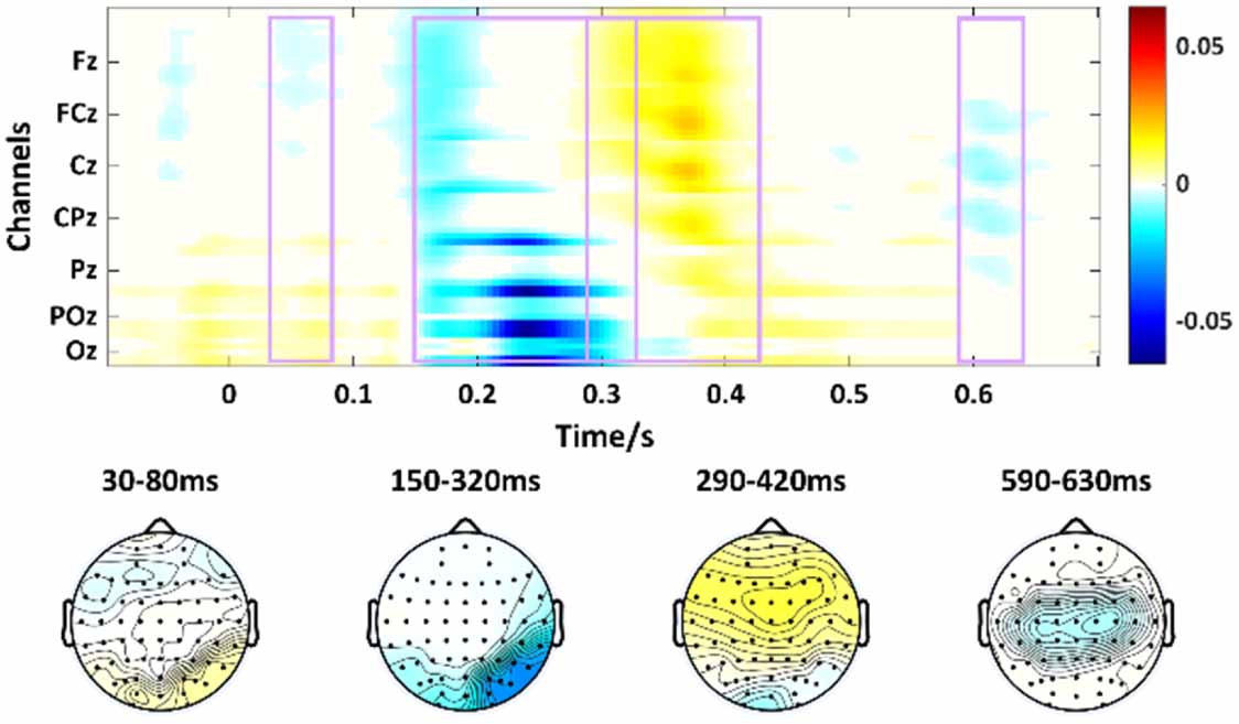 Enhancement for P300-speller classification using multi-window ...