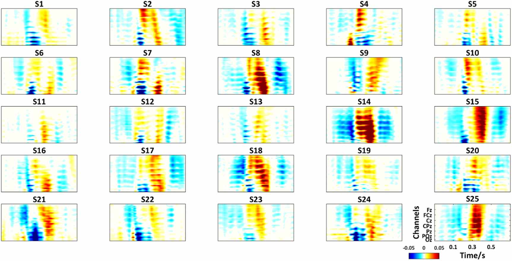 Enhancement for P300-speller classification using multi-window ...