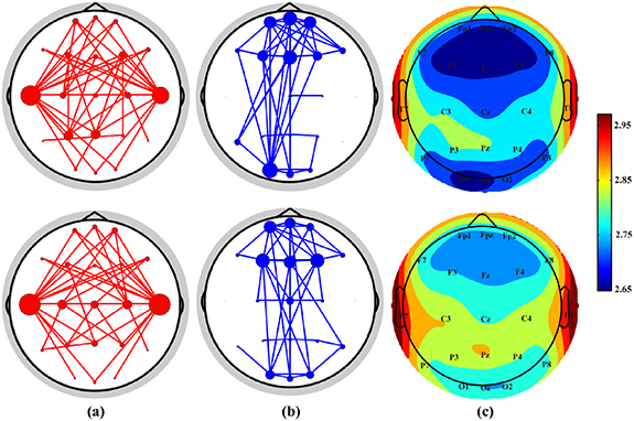 Brain variability in dynamic resting-state networks identified by fuzzy entropy: a scalp EEG ...