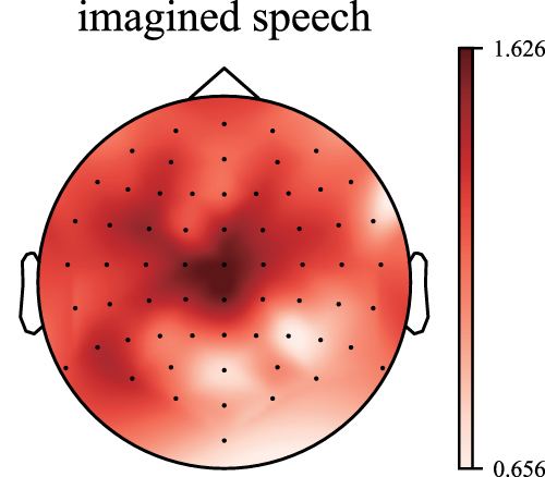 Decoding imagined speech from EEG signals using hybrid-scale spatial-temporal dilated ...