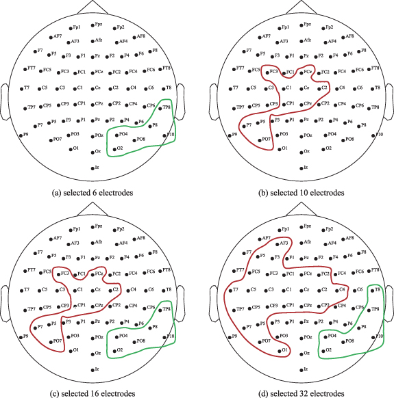 Decoding imagined speech from EEG signals using hybrid-scale spatial-temporal dilated ...