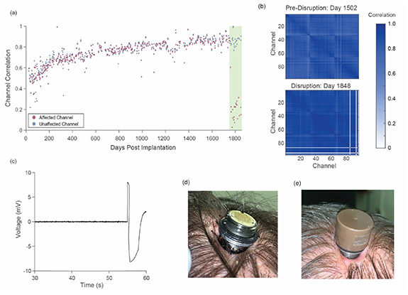 Long-term intracortical microelectrode array performance in a human: a ...