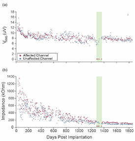 Long-term intracortical microelectrode array performance in a human: a ...