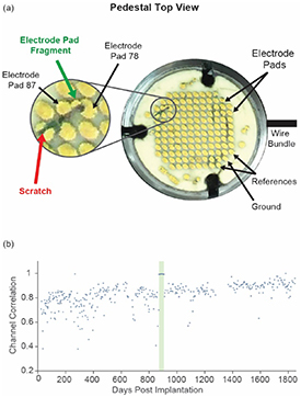 Long-term intracortical microelectrode array performance in a human: a ...