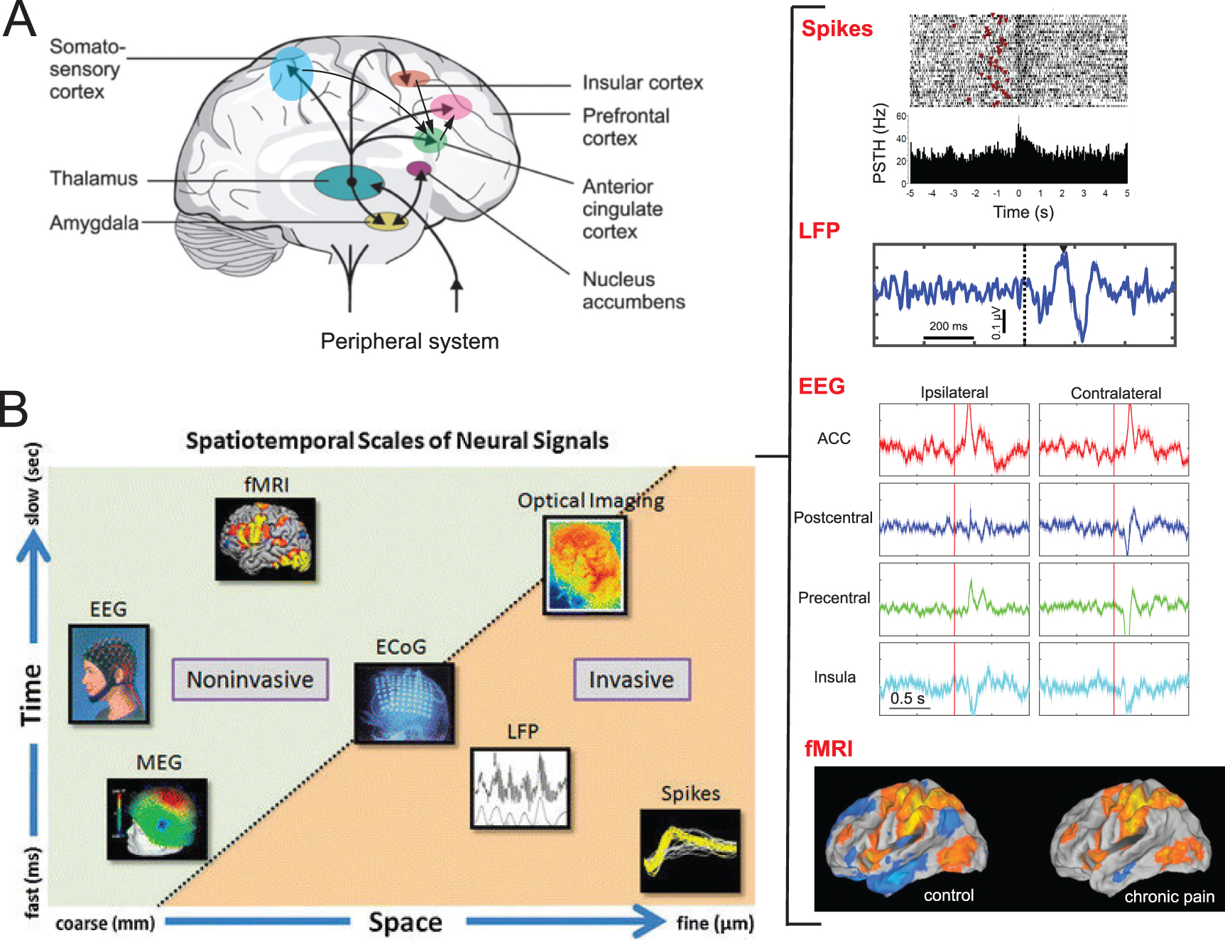 Decoding pain from brain activity - IOPscience