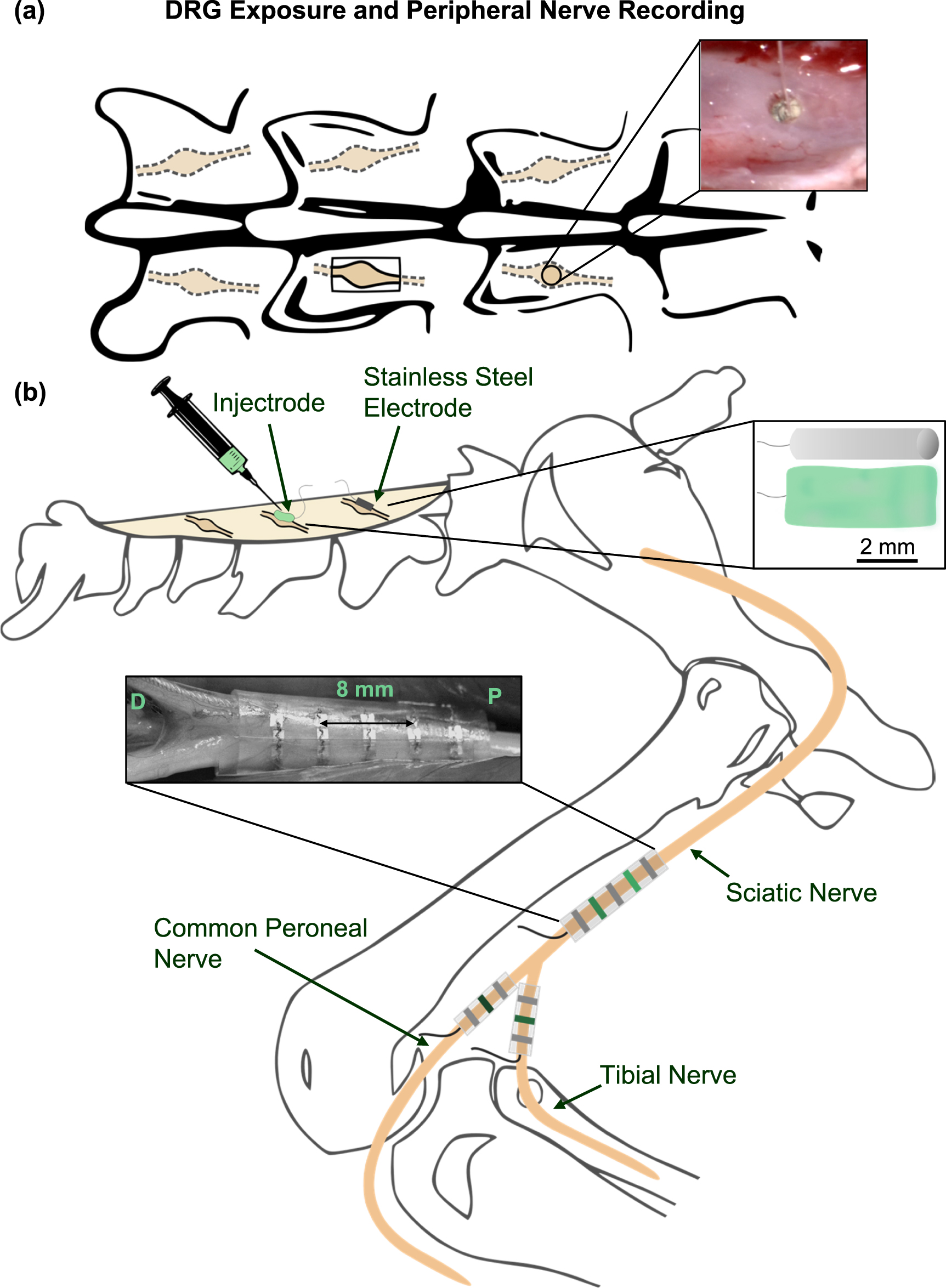 Stimulation of the dorsal root ganglion using an Injectrode® - IOPscience