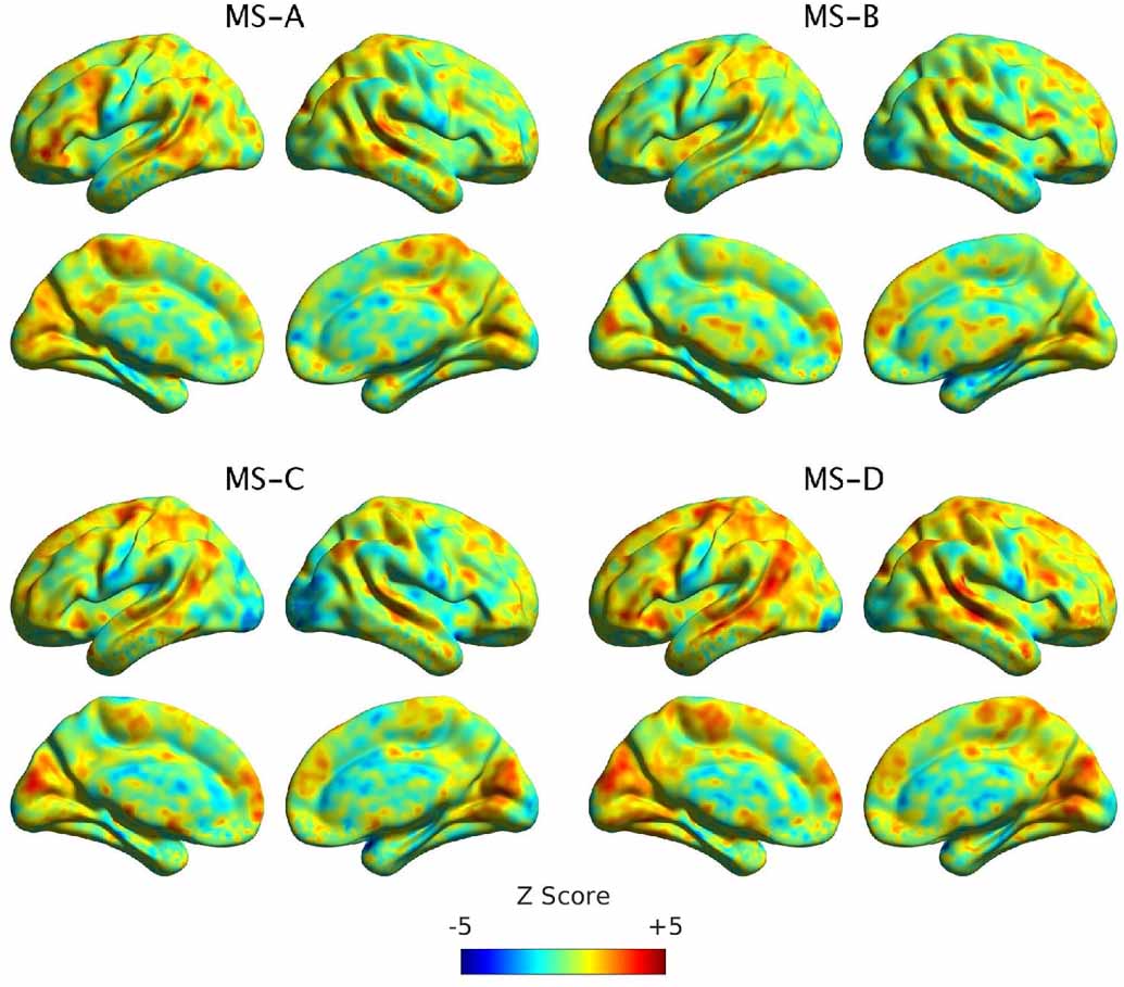 Canonical EEG microstates transitions reflect switching among BOLD ...