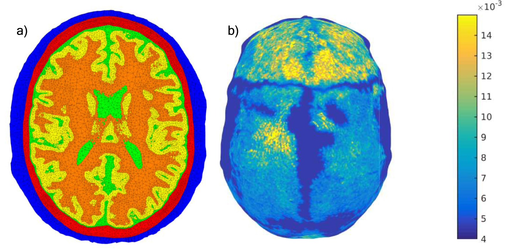 Impact of skull sutures, spongiform bone distribution, and aging skull ...