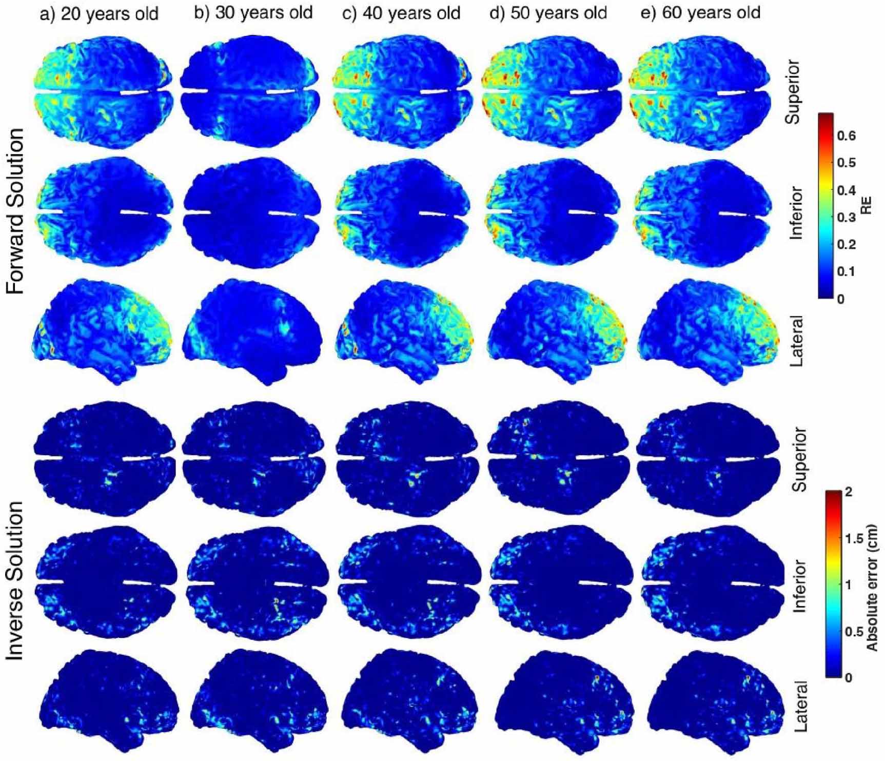 Impact of skull sutures, spongiform bone distribution, and aging skull ...