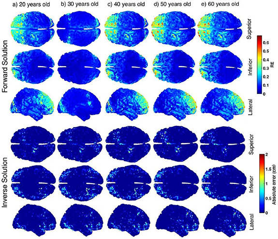 Impact of skull sutures, spongiform bone distribution, and aging skull ...