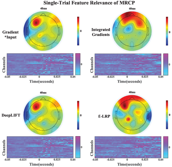 IENet: a robust convolutional neural network for EEG based brain-computer interfaces - IOPscience