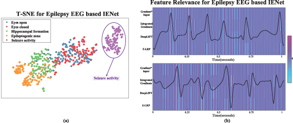 IENet: a robust convolutional neural network for EEG based brain-computer interfaces - IOPscience