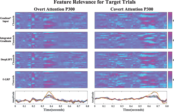 IENet: a robust convolutional neural network for EEG based brain-computer interfaces - IOPscience
