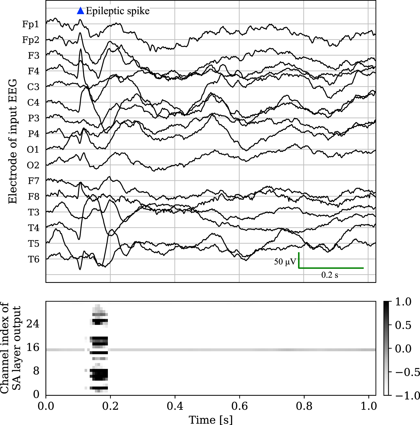 Satelight: self-attention-based model for epileptic spike detection ...