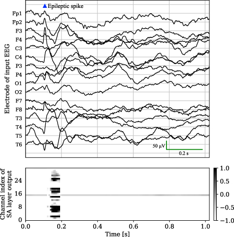 Satelight: self-attention-based model for epileptic spike detection ...