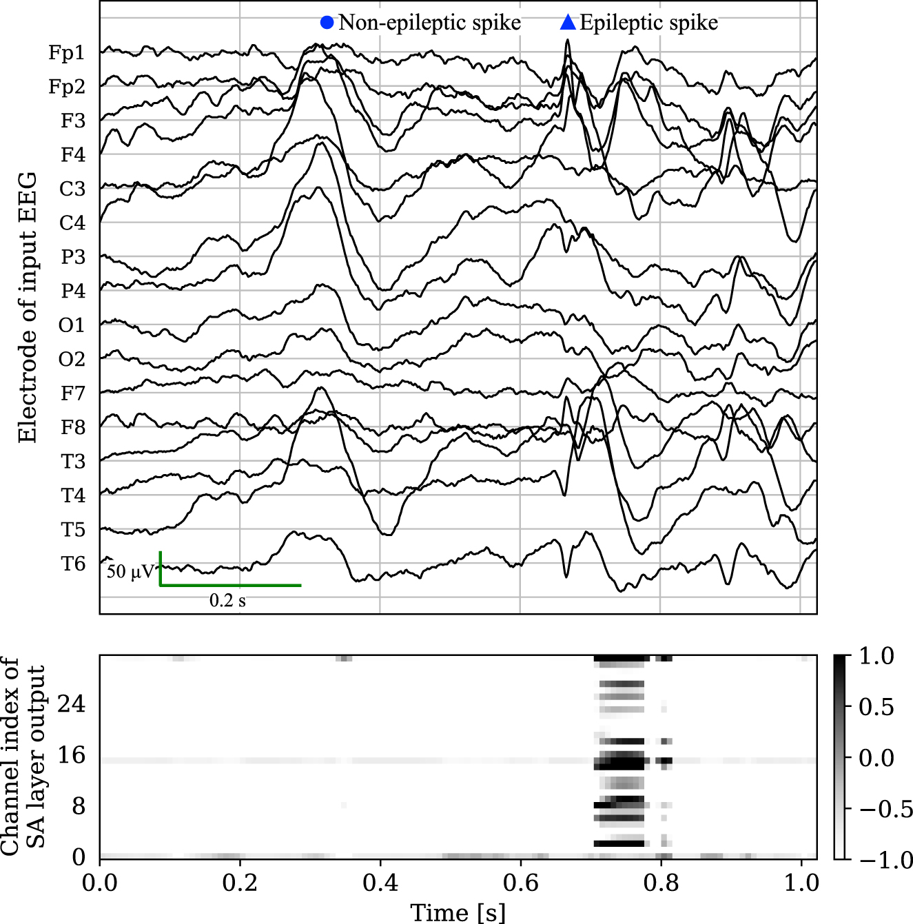 Satelight: self-attention-based model for epileptic spike detection ...