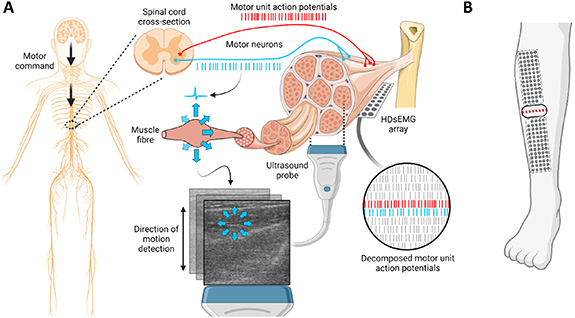 Kinematics of individual muscle units in natural contractions measured ...