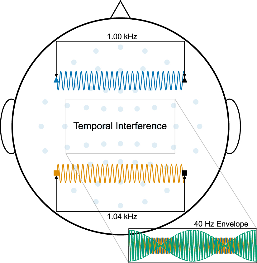 Non-invasive stimulation with temporal interference: optimization of ...