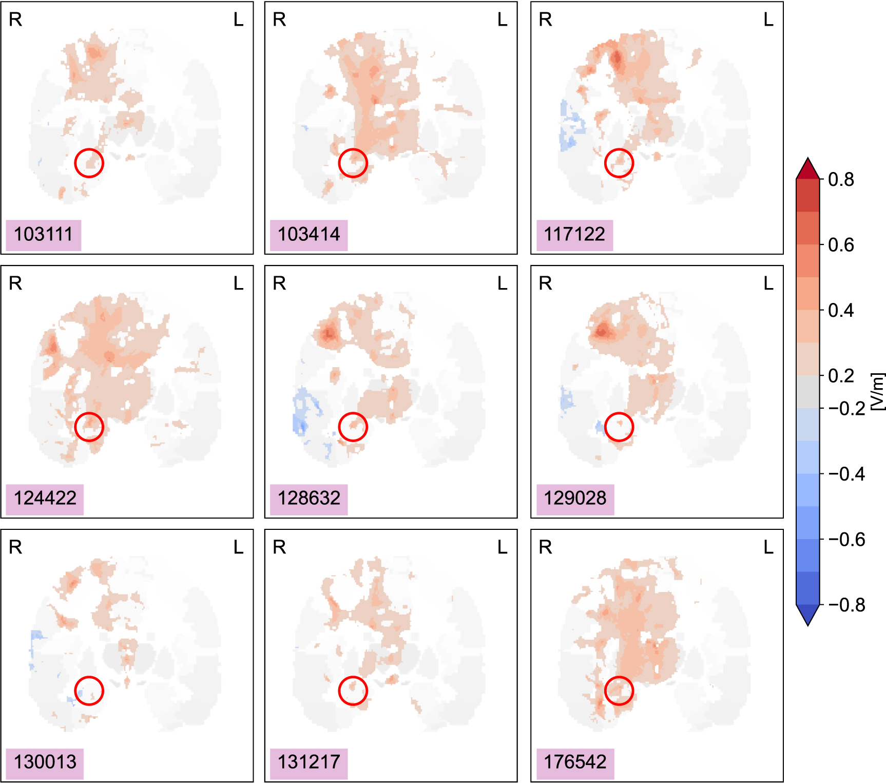 Non-invasive stimulation with temporal interference: optimization of ...