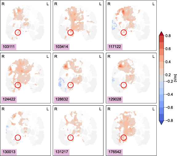 Non-invasive stimulation with temporal interference: optimization of ...