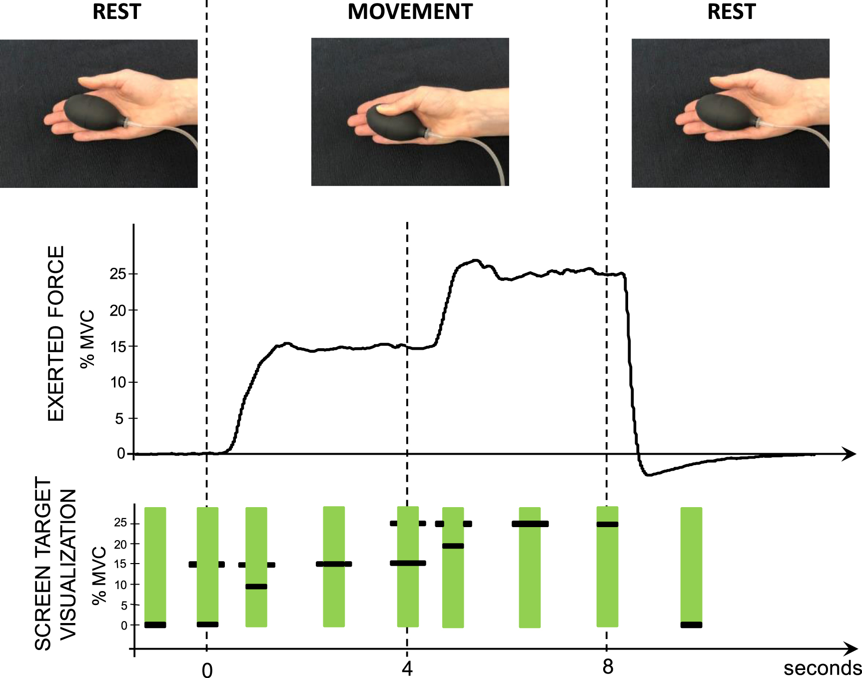 Brain electrical microstate features as biomarkers of a stable motor ...