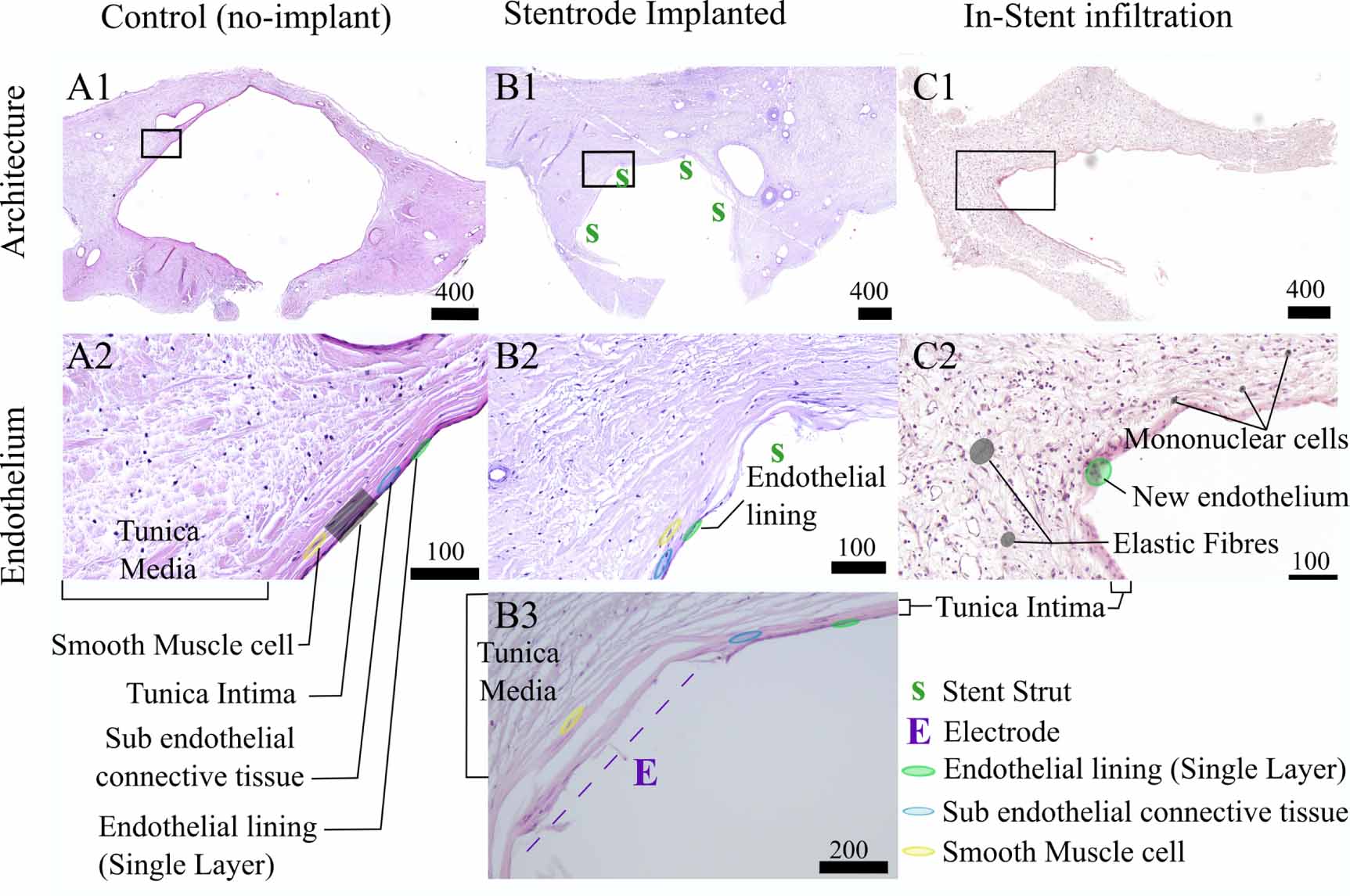Vascular remodeling in sheep implanted with endovascular neural ...