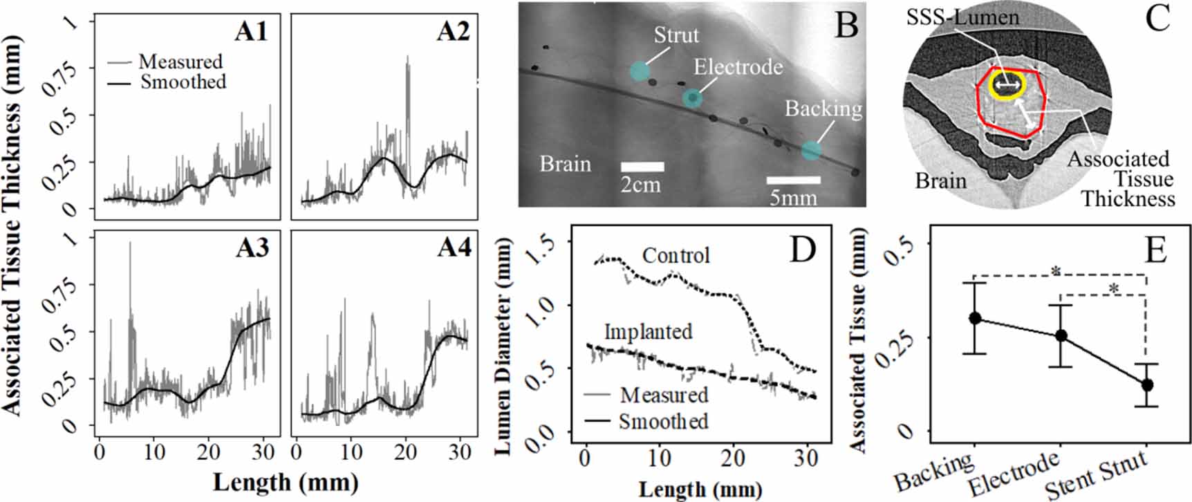 Vascular remodeling in sheep implanted with endovascular neural ...