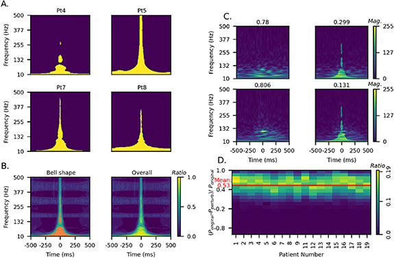 Characterizing physiological high-frequency oscillations using deep learning - IOPscience