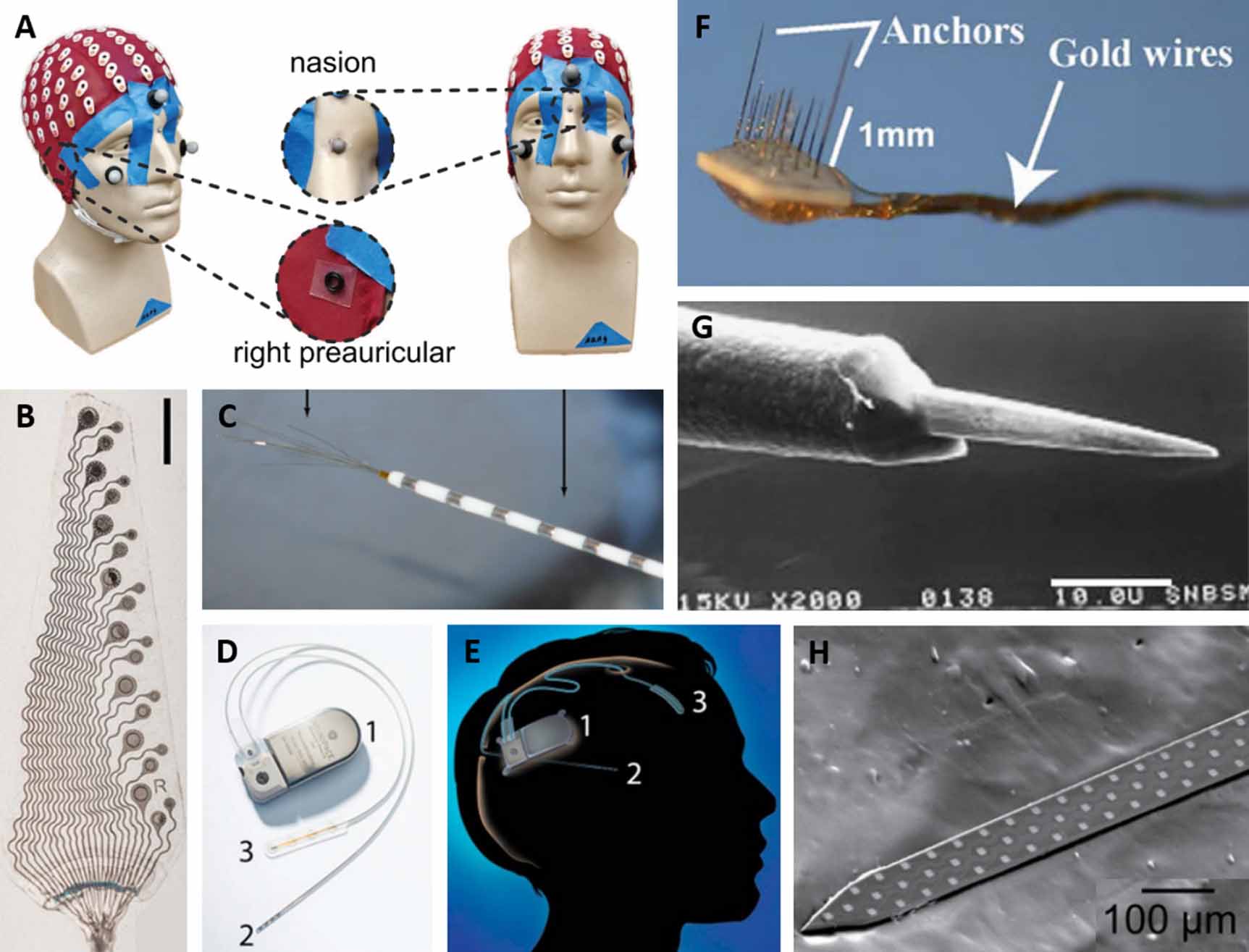 Making a case for endovascular approaches for neural recording and ...