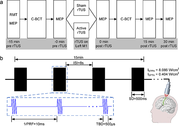 Transcranial ultrasound stimulation modulates the interhemispheric ...