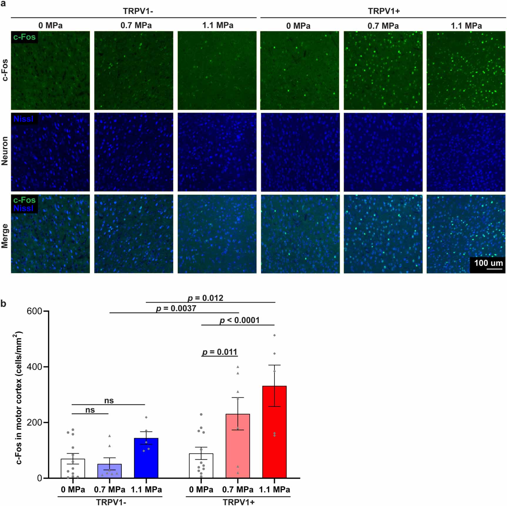 TRPV1-mediated sonogenetic neuromodulation of motor cortex in freely ...