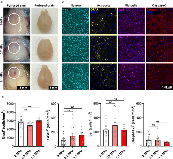 TRPV1-mediated sonogenetic neuromodulation of motor cortex in freely ...