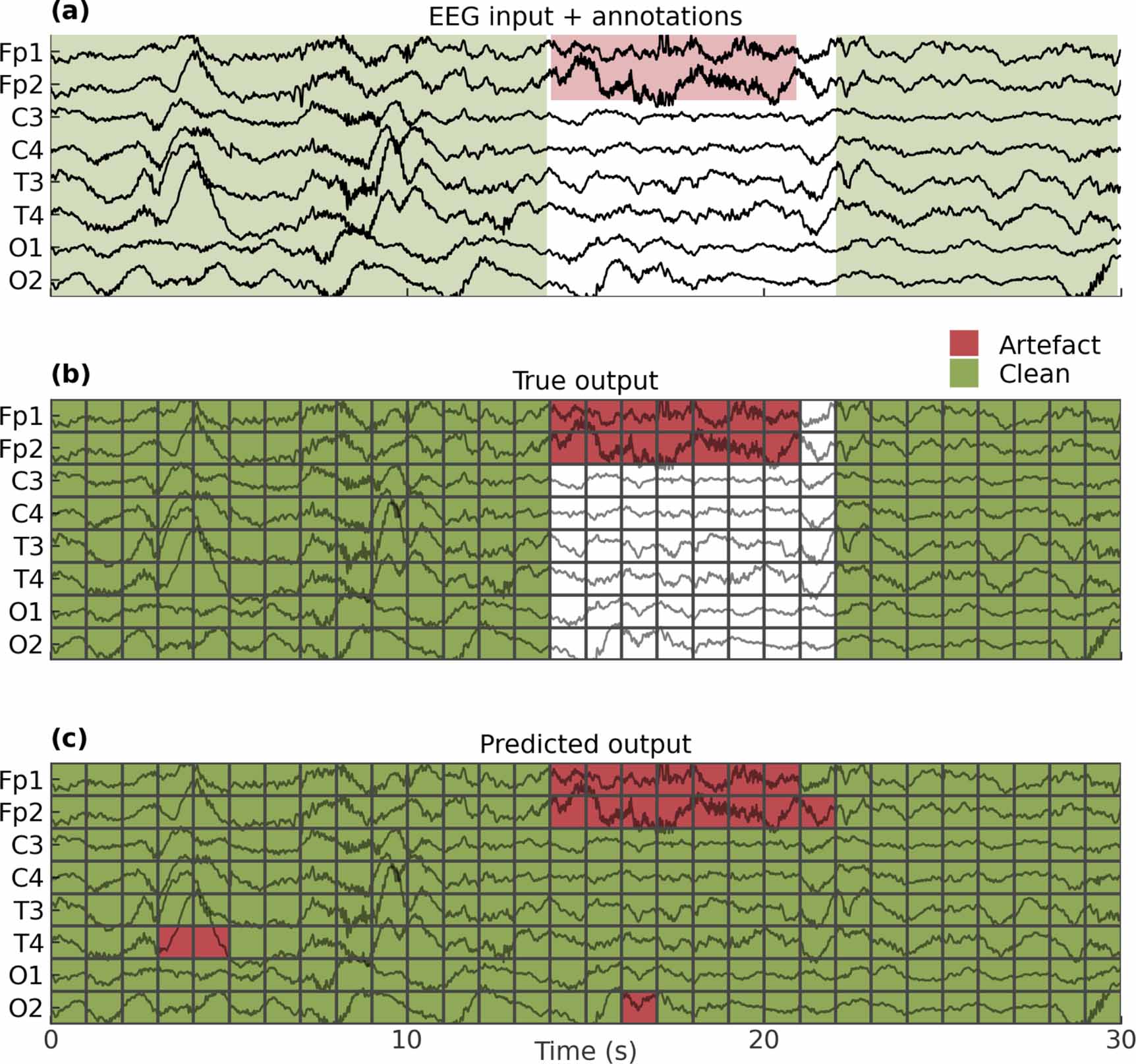 A multi-task and multi-channel convolutional neural network for semi-supervised neonatal ...