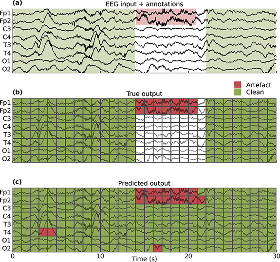 A multi-task and multi-channel convolutional neural network for semi-supervised neonatal ...