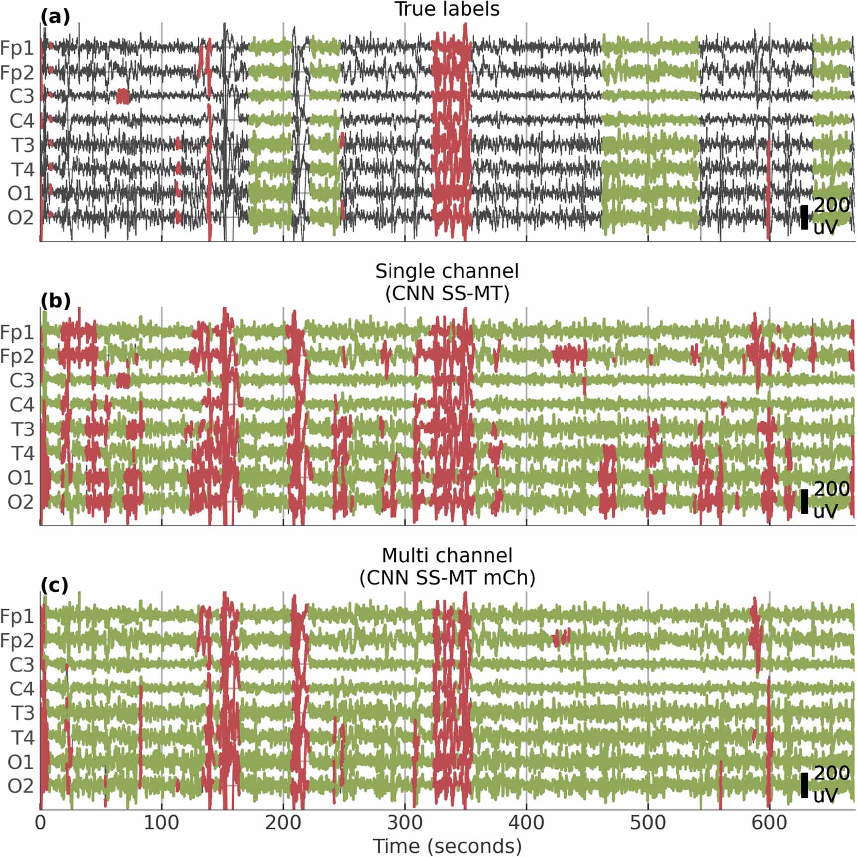 A multi-task and multi-channel convolutional neural network for semi-supervised neonatal ...