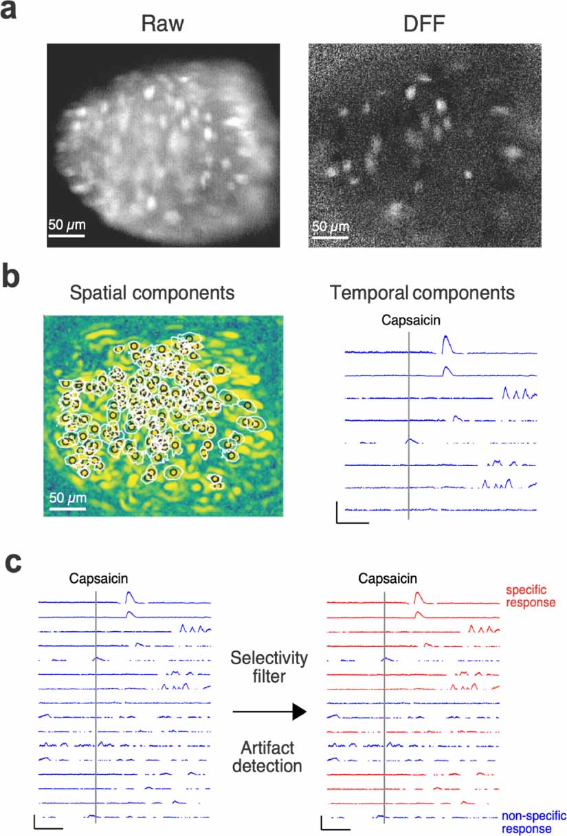 Calcium imaging and analysis of the jugular-nodose ganglia enables ...