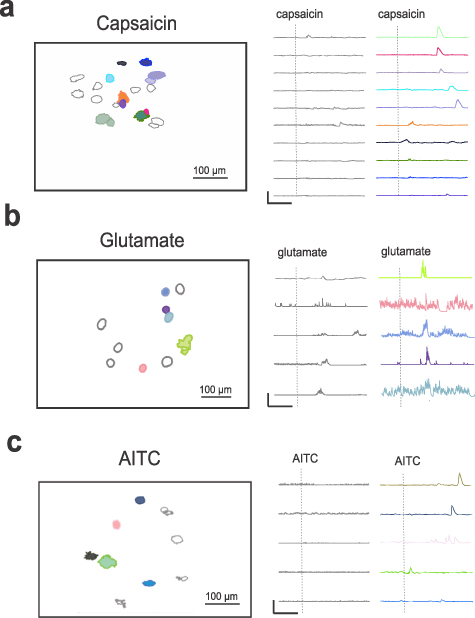 Calcium imaging and analysis of the jugular-nodose ganglia enables ...