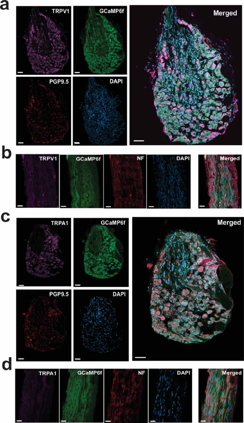 Calcium imaging and analysis of the jugular-nodose ganglia enables ...
