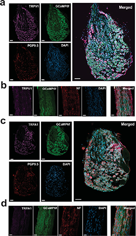 Calcium imaging and analysis of the jugular-nodose ganglia enables ...